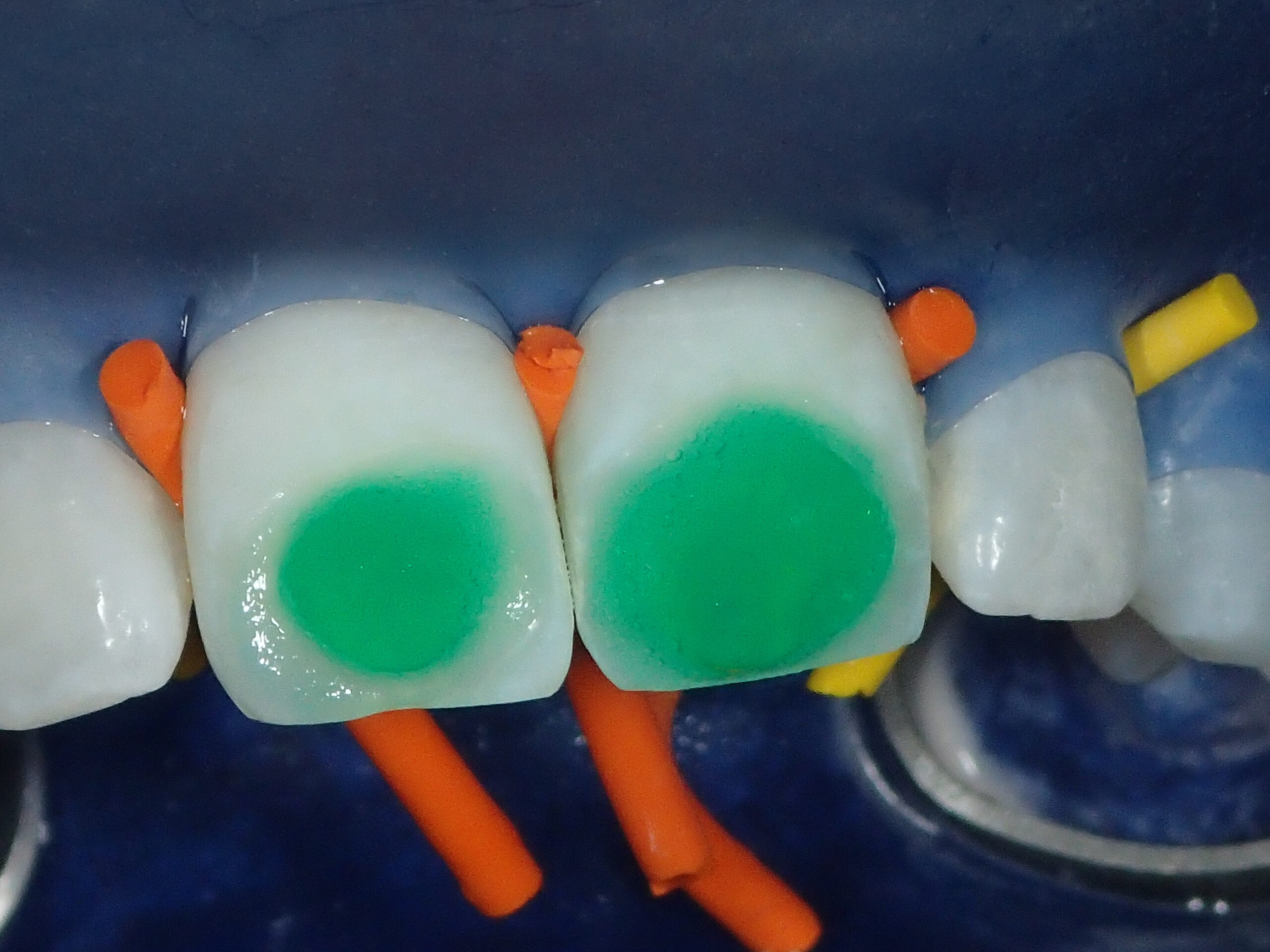 Nos soins dentaires en images