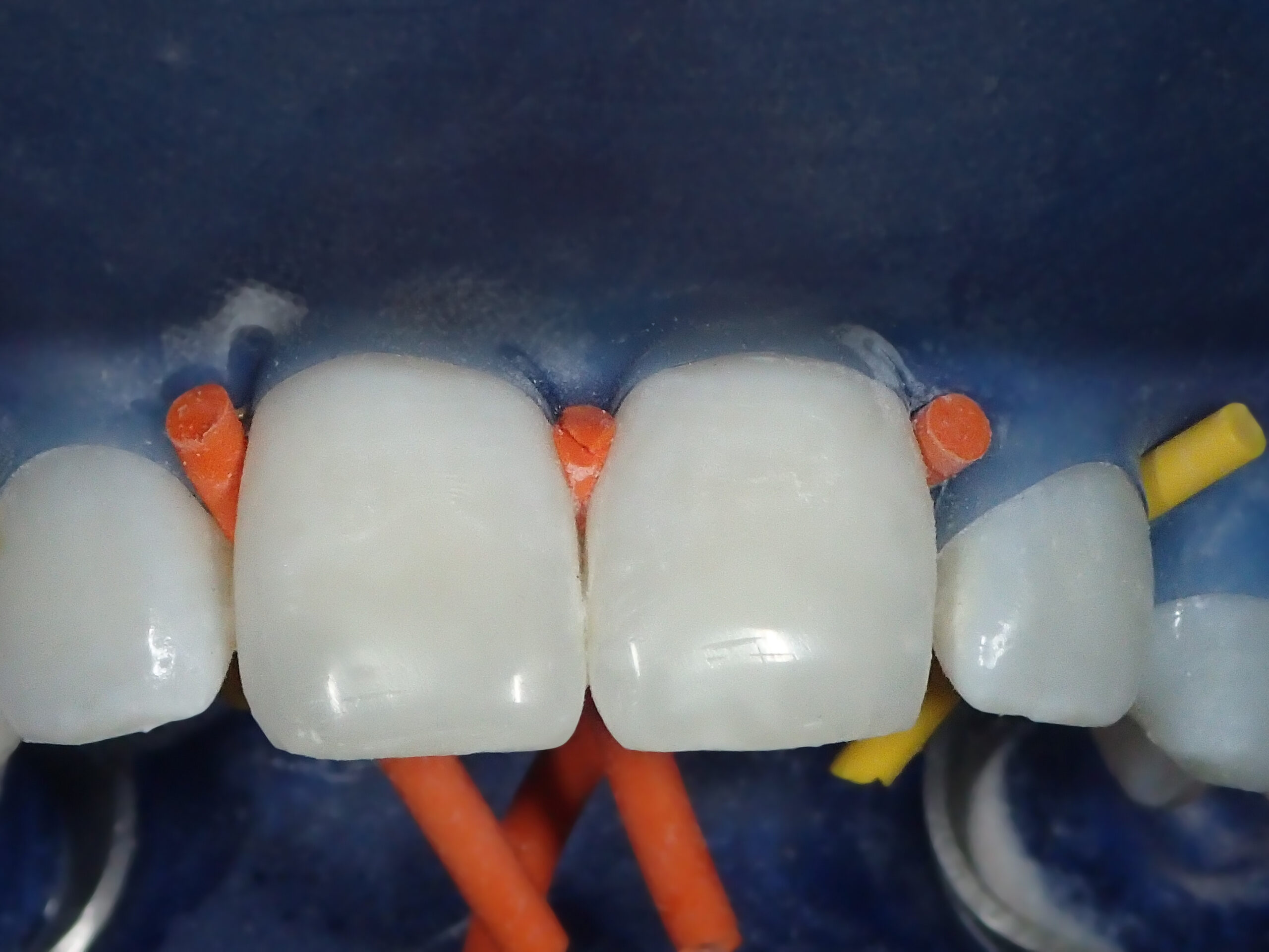 Nos soins dentaires en images